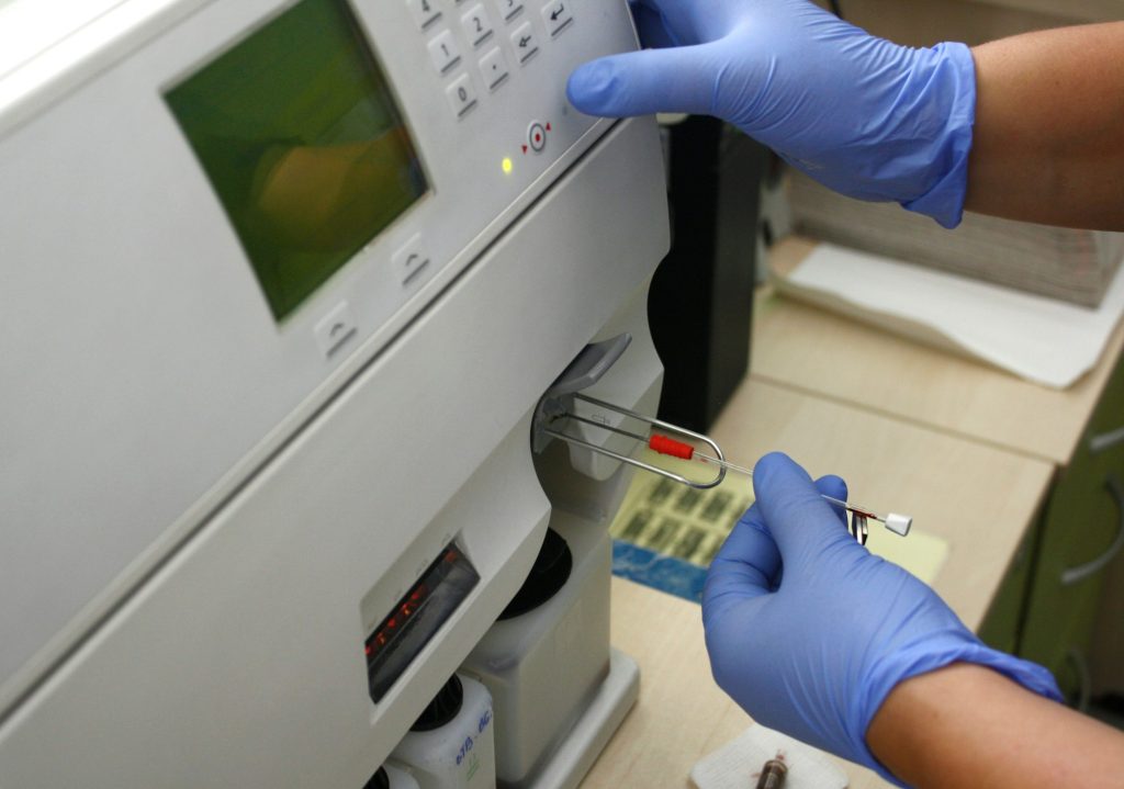 Alcohol and Other Drug Testing | Workplace Health Services